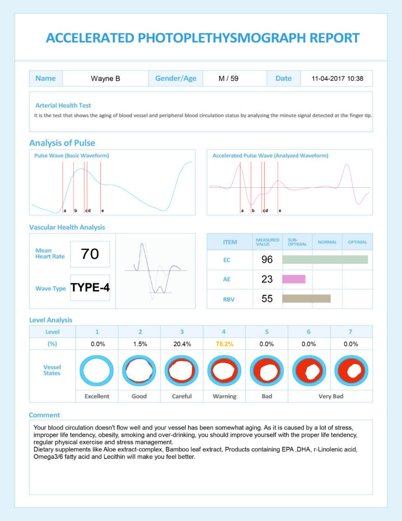 Max-Pulse-test-arterial - Max Pulse